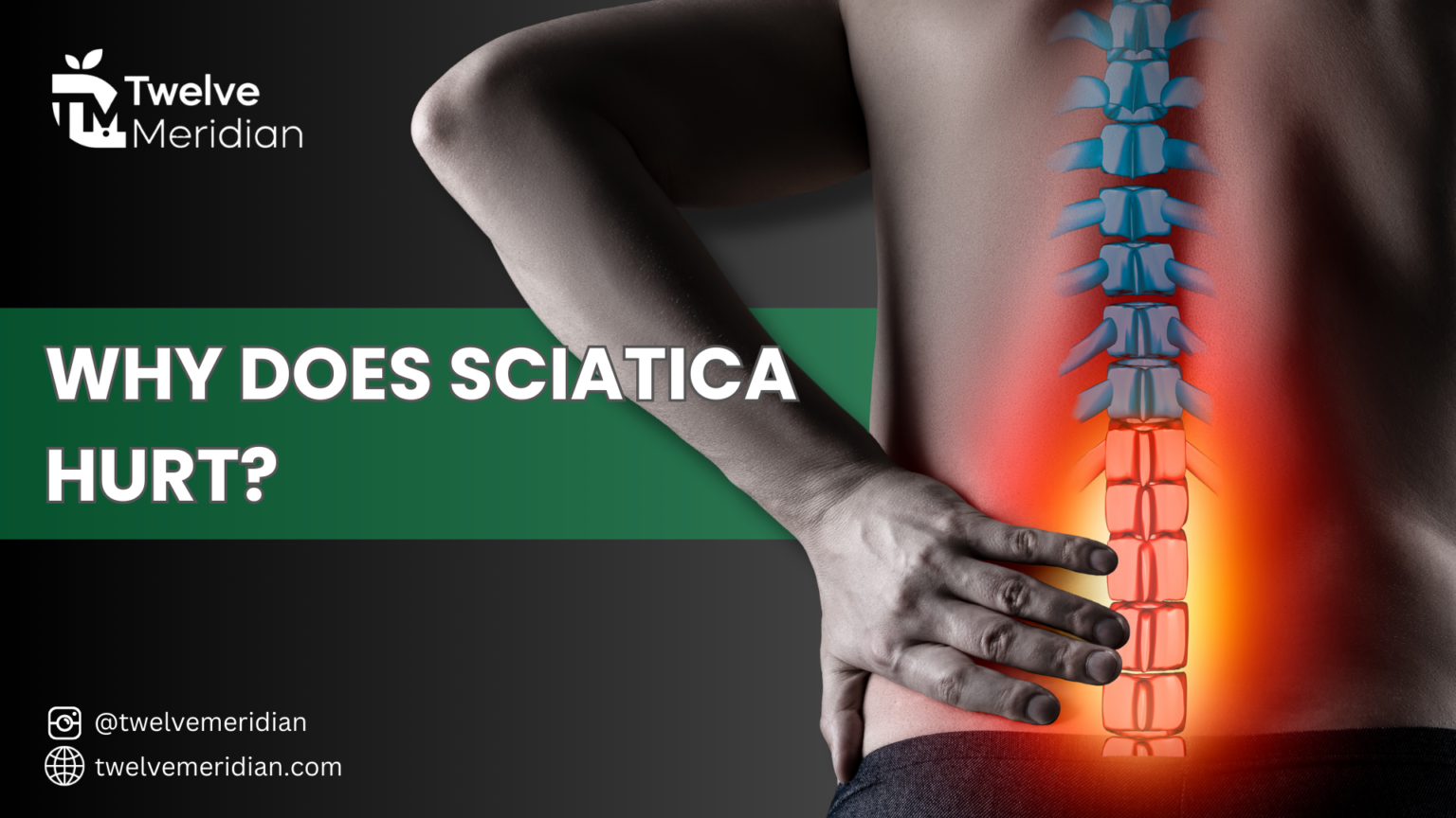 Sciatica Pain: Symptoms, Treatment, And Prevention Tips | Twelve Meridian